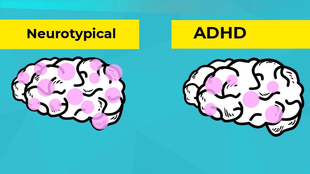 Video Infographic : Infographics: What is ADHD? – Infographic.tv ...