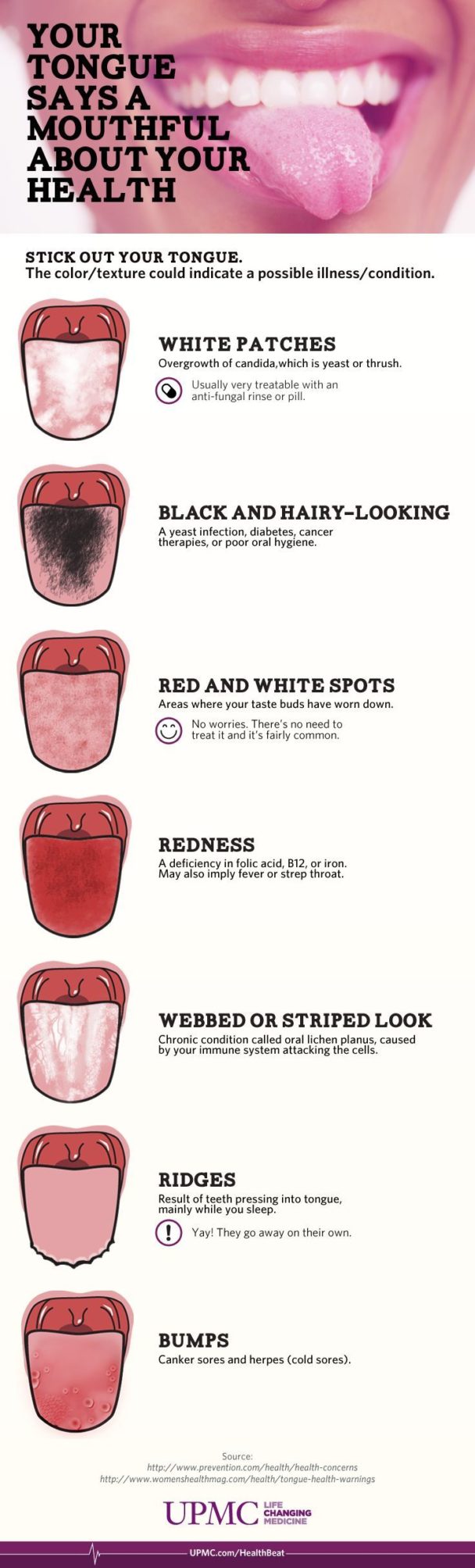 Data Chart : What Does Your Tongue Say About Your Health Infographic ...
