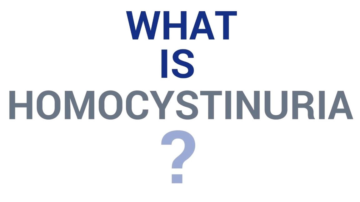 Video Infographic : Homocystinuria Infographic – Infographic.tv ...