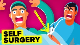 Video Infographic : Why A Doctor Removed His Own Appendix – Infographic ...