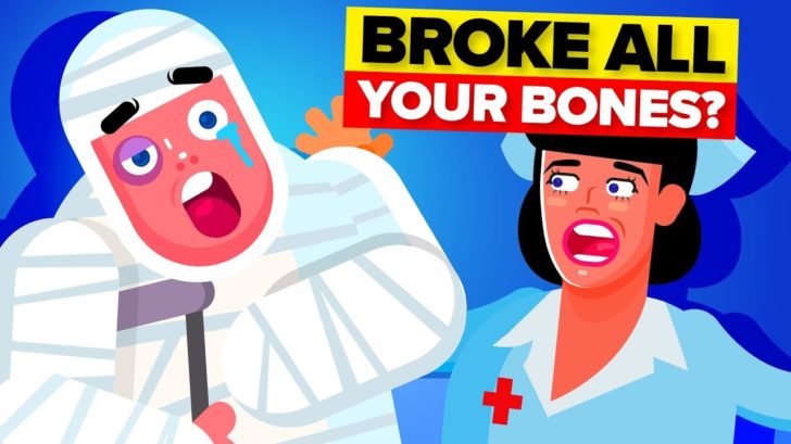 Video Infographic : What If YOU Broke EVERY Bone In Your Body ...