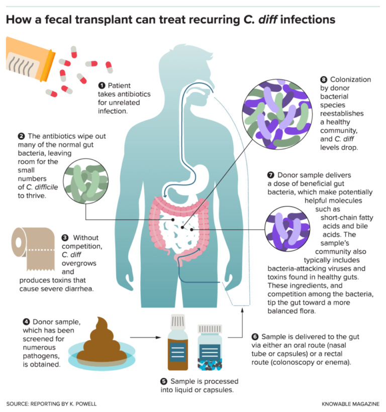 Chart : Infographic: How fecal transplants work against recurrent C ...
