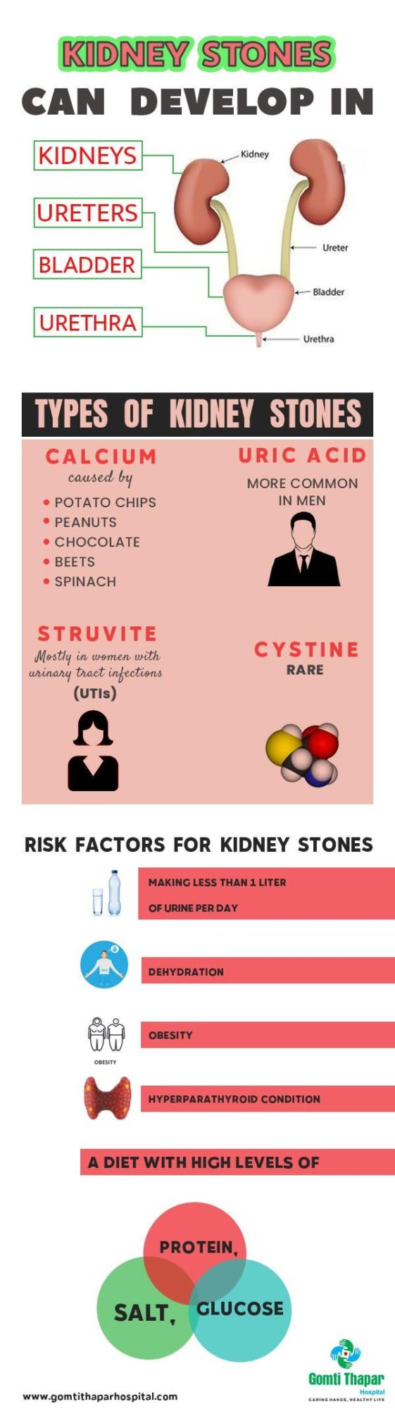 Infographic : Kidney Stones Can Develop In – Infographic.tv – Number ...